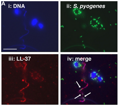 抗菌肽LL-37：为抗菌肽的应用开辟了新的领域 - amyjetsci - 分析测试百科网